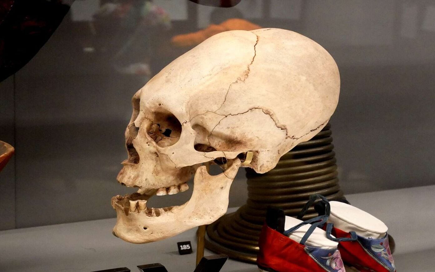 DNA Analysis of Conehead Mummies Deepens Mystery of Peru’s Paracas ...