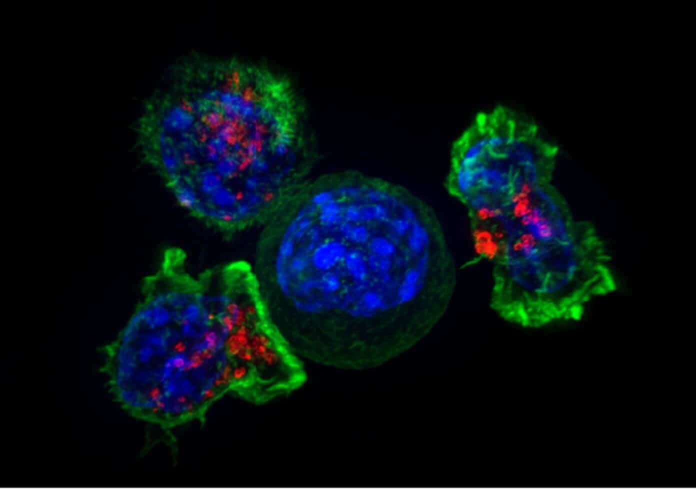 US Cancer Survival Reaches Historic High of 70% - GreekReporter.com