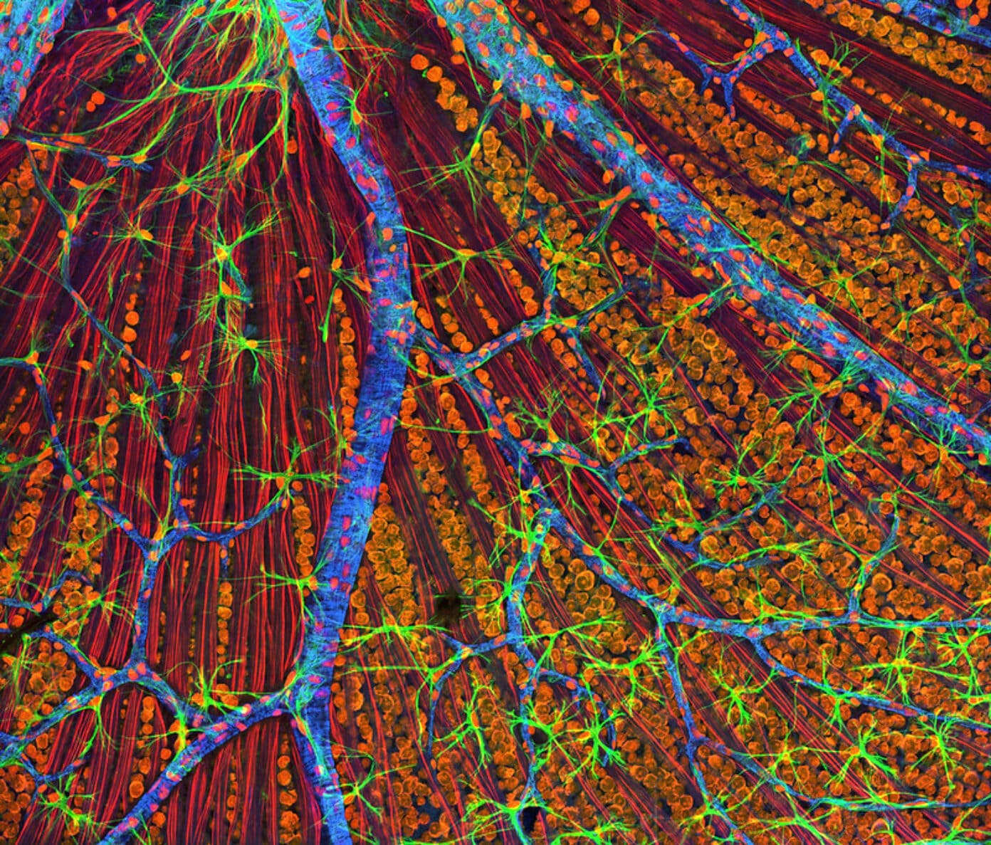 Can Aging Cells Be Made Young Again? New Human Trial Seeks Answers ...