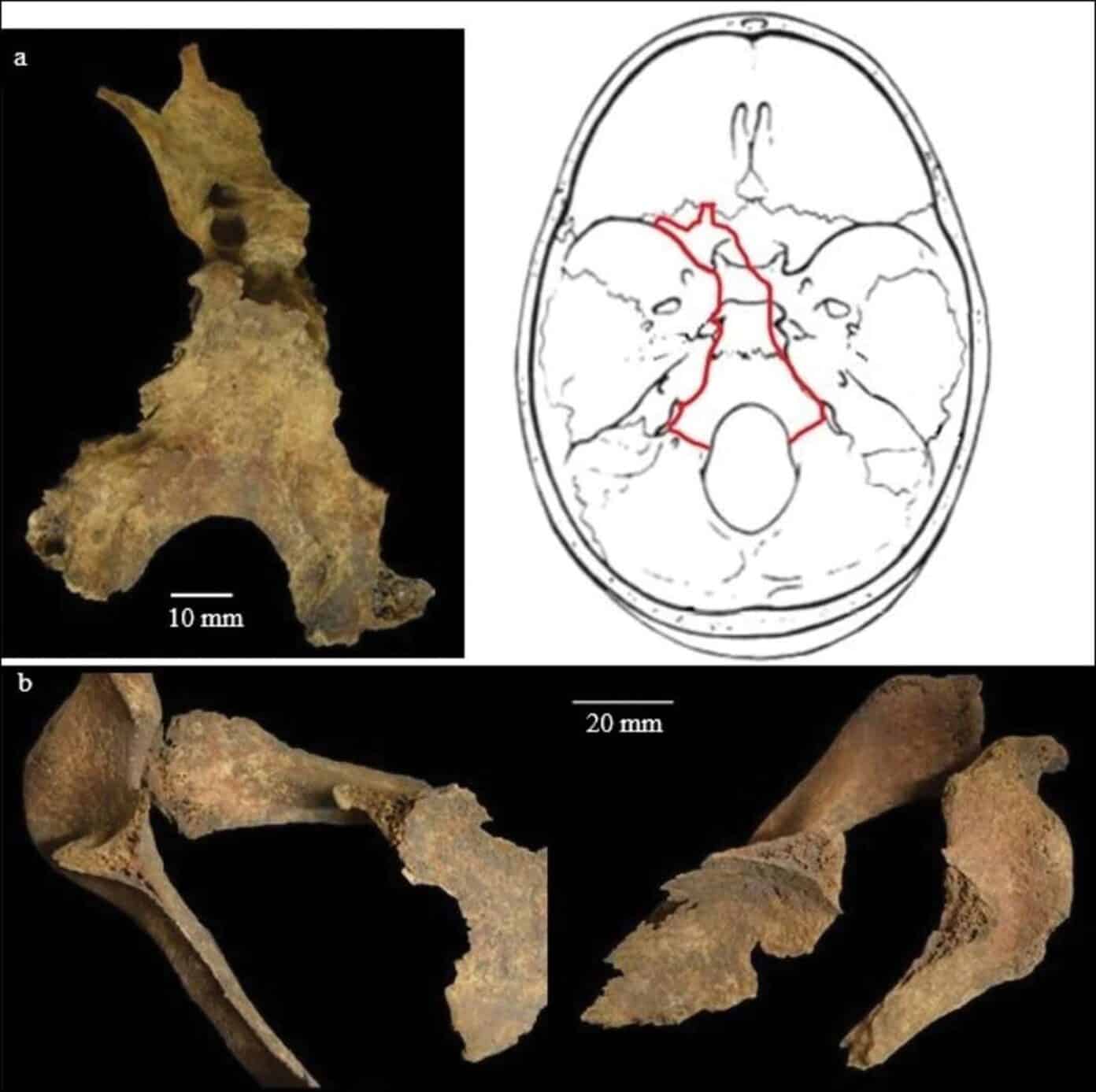 Ancient Burial in Scotland Shows Woman’s Brain May Have Been Removed ...